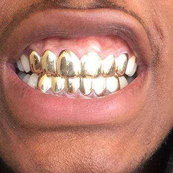 The Plug Jewelry & Gold Teeth Grillz - 123 Photos & 35 Reviews ...