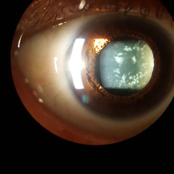 City Eyeworks - 13 Photos & 46 Reviews - Optometrists - 5101 25th Ave ...