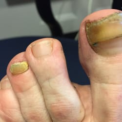 Tips & Toes Spa - 21 Photos & 18 Reviews - Nail Salons - 216 Main St ...