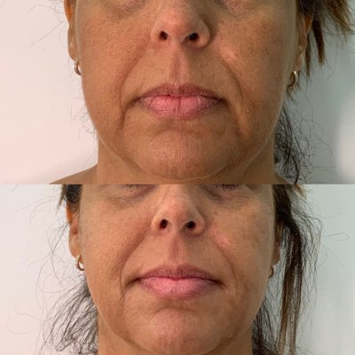 Dr Landa Med Spa, 981 E Commercial Blvd, Oakland Park, FL - MapQuest