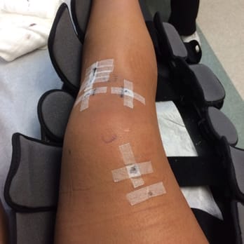 Alison J Rozansky, MD - 24 Reviews - Orthopedists - 5353 Balboa Blvd ...