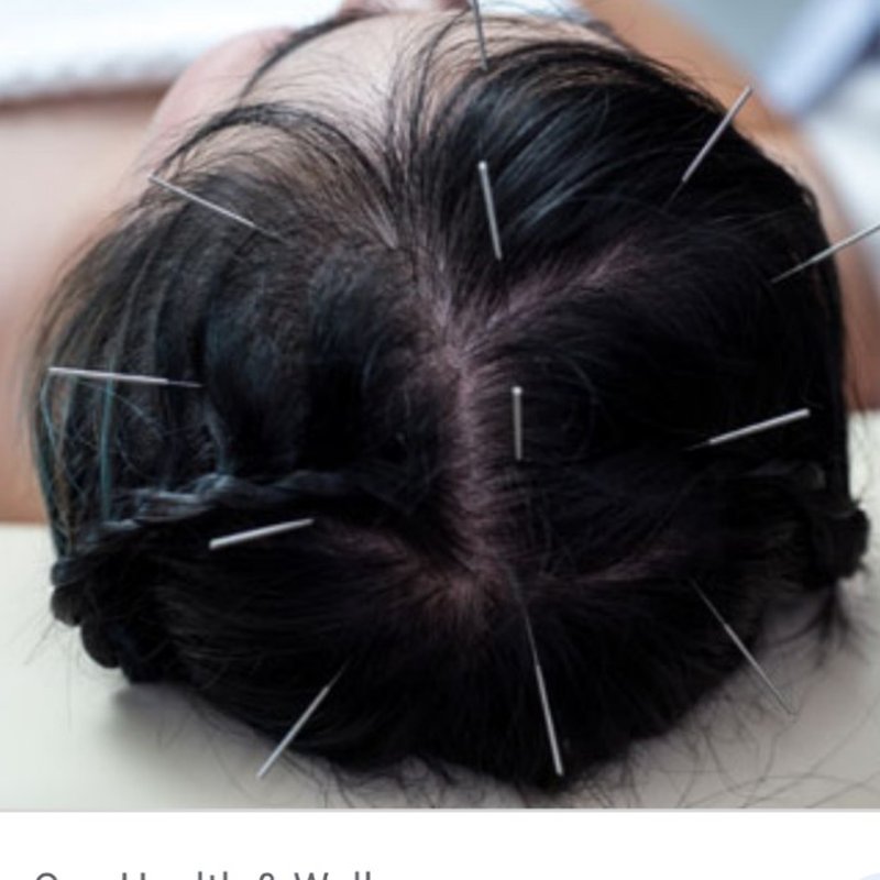 GREENLAKE ACUPUNCTURE AND CHINESE MEDICINE CLINIC - 1111 N 82nd St ...