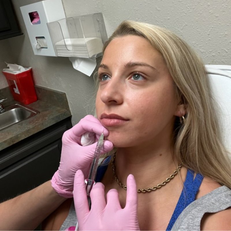 BOGO Half Off -Filler Special